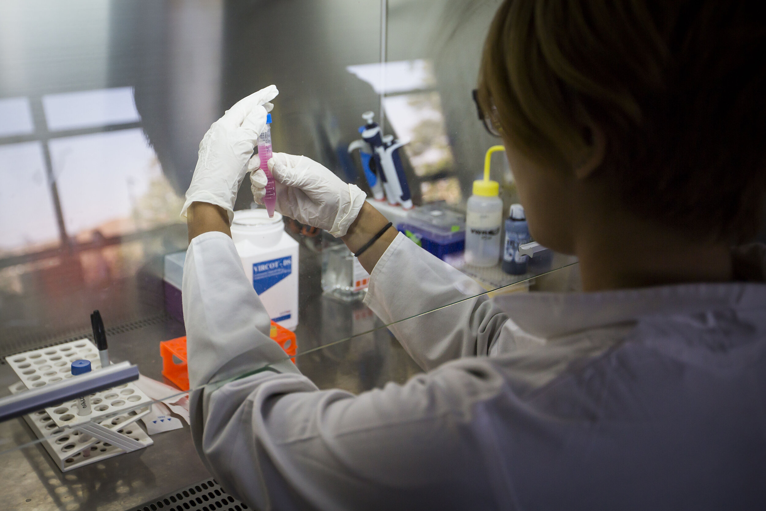 Childhood Tuberculosis (TB) Program | Texas Children's