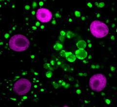 Two independent mechanisms are involved in tuberous sclerosis | Texas ...