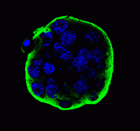 Mutations in an early embryonic development gene may cause female ...