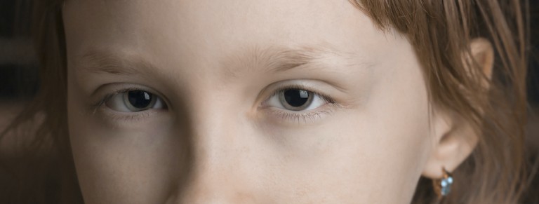 Antiperspirant wipes and pupil changes in children | Texas Children's
