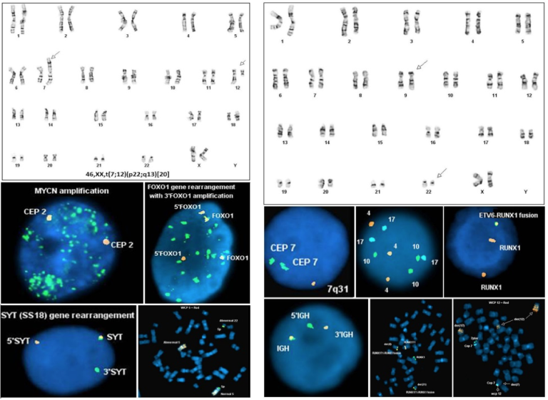 Cancer Cytogenetics Core Laboratory | Texas Children's