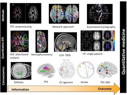 Radiology Neuroradiology Research Group | Texas Children's