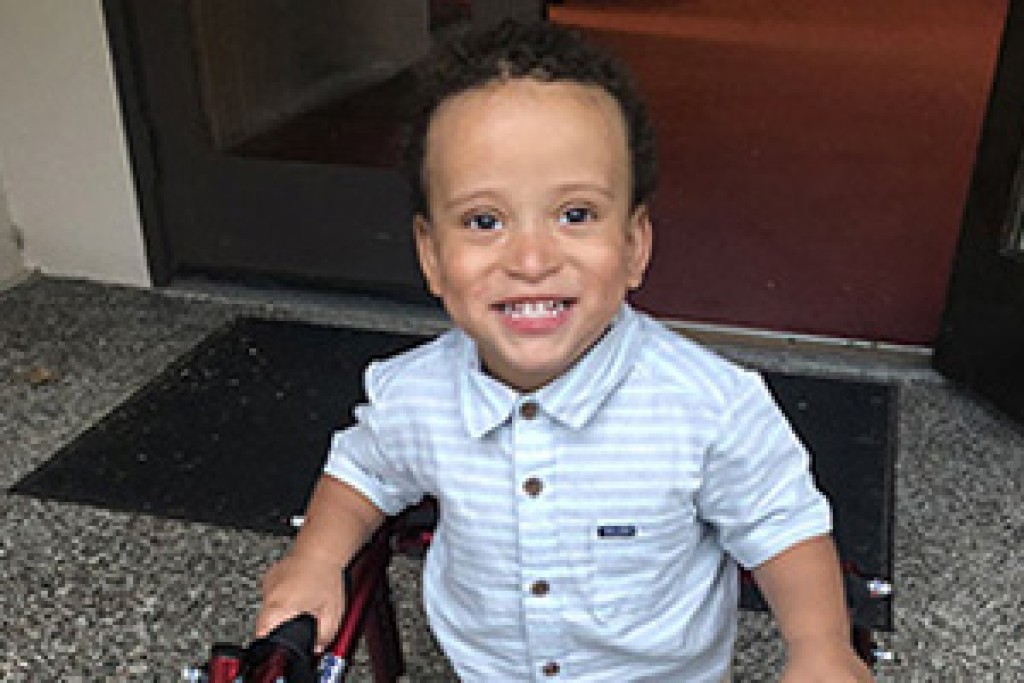 Spina Bifida (Myelomeningocele) | Texas Children's
