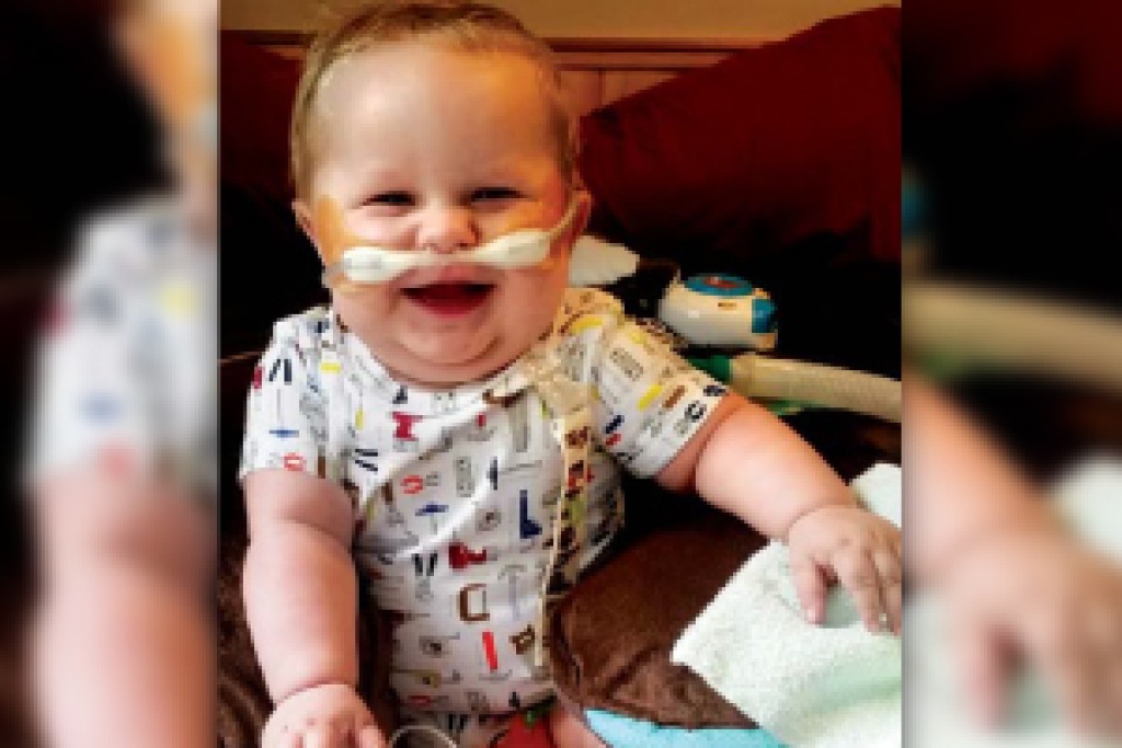 Congenital Diaphragmatic Hernia (CDH) | Texas Children's