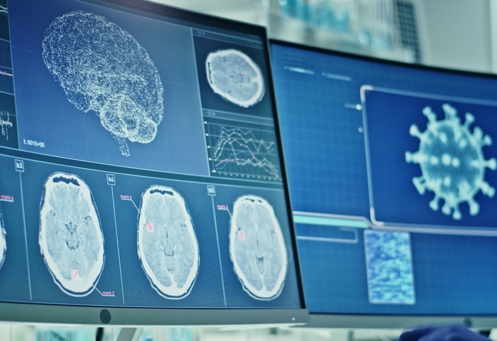 An in-depth review on neurodevelopmental effects of COVID in children | Texas Children's