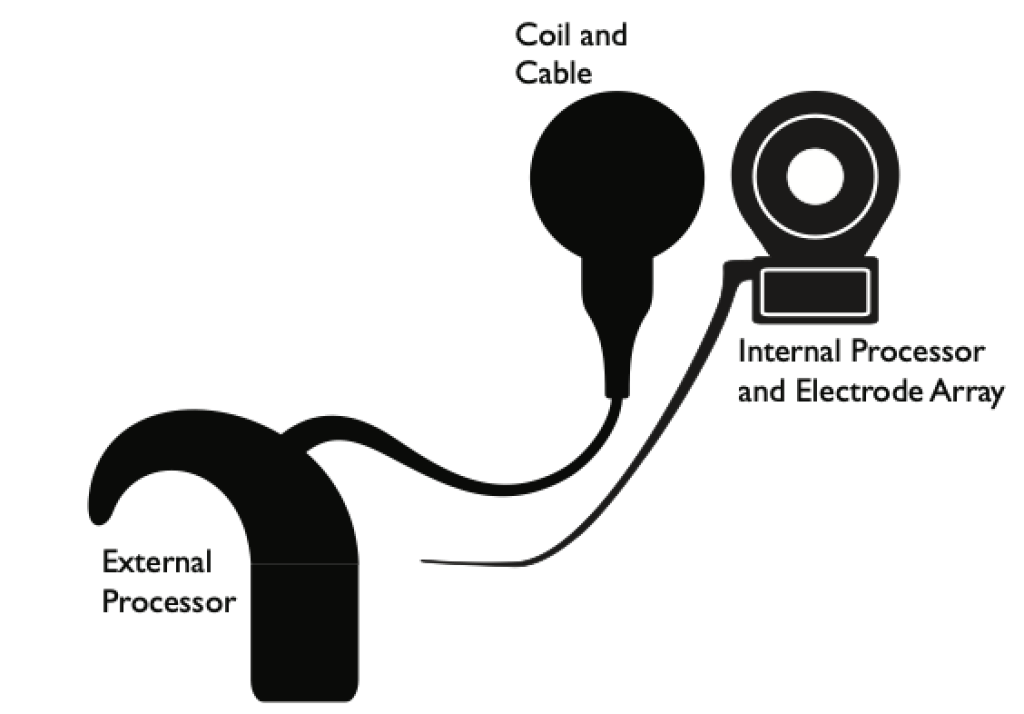 Cochlear Implant Program FAQs | Texas Children's