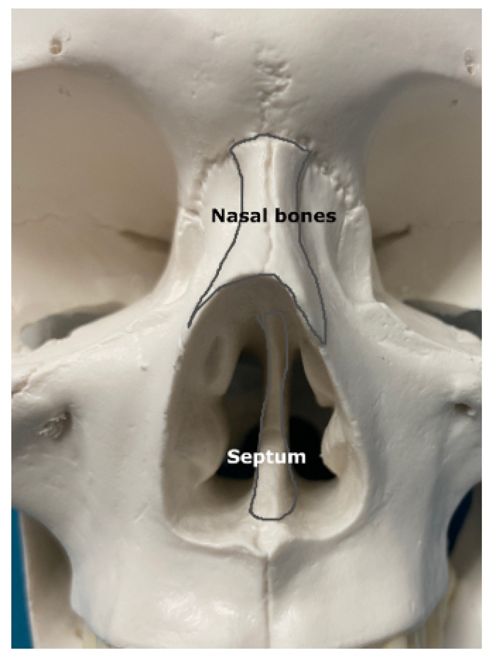 Nasal Fractures at North Austin Campus | Texas Children's