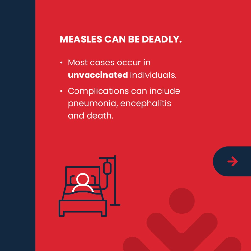Measles: Here’s what you need to know | Texas Children's