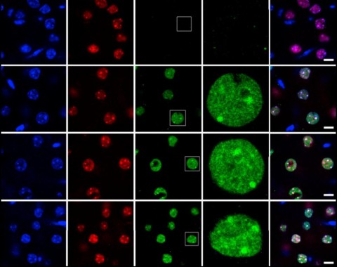 Mutation location is the key to prognosis | Texas Children's