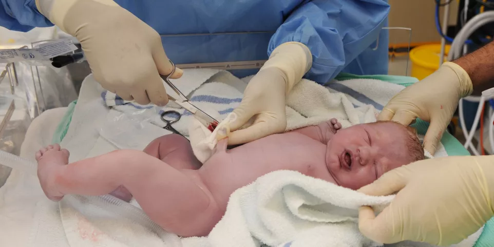 Here's why delayed cord clamping is the new normal | Texas Children's