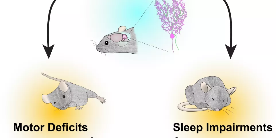 cerebellar dysfunction often causes