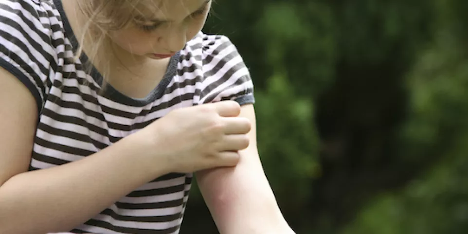 Mosquito Bites: How To Be Prepared | Texas Children's