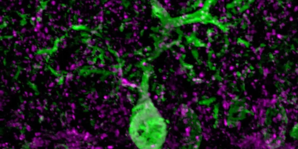 Sillitoe Lab's Work Featured in The Scientist | Texas Children's