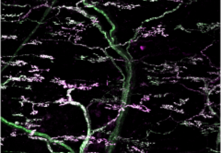 A new way to visualize force-sensing neurons | Texas Children's