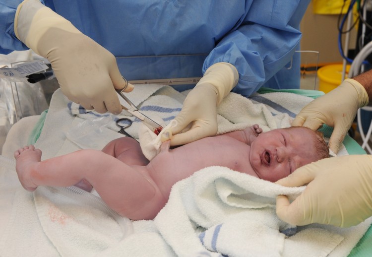 Here's why delayed cord clamping is the new normal | Texas Children's