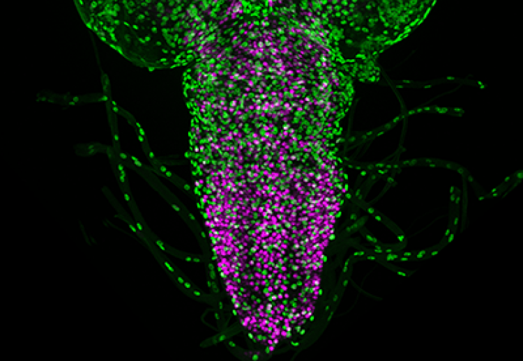 FRYL gene variants linked to a new neurological disorder | Texas Children's