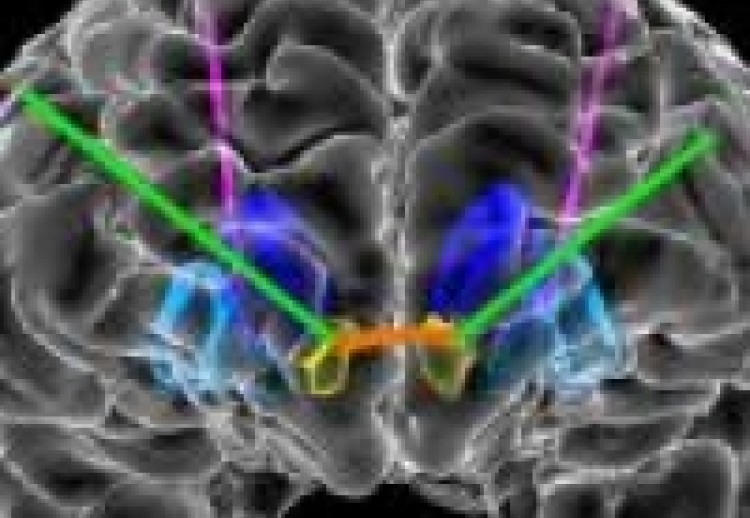 Texas Children’s And Baylor College Researchers Use Innovative Dual ...