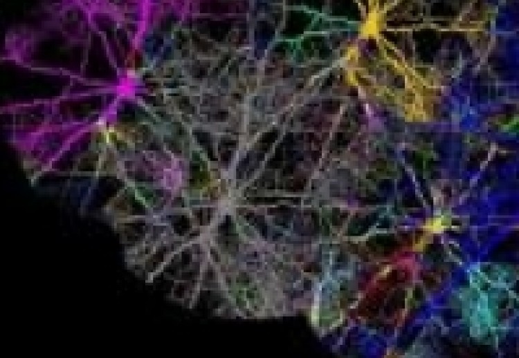Imaging Brain Connections Can Predict Improvements In Obsessive ...
