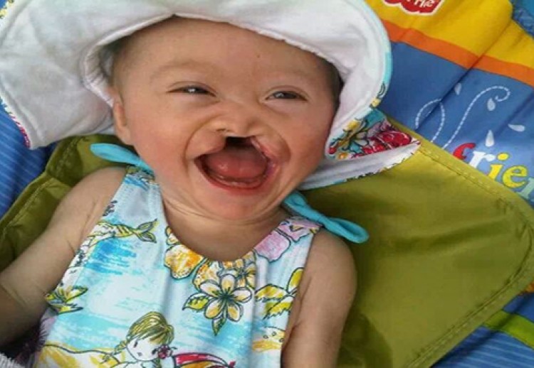 Our Journey With Holoprosencephaly: Part One | Texas Children's