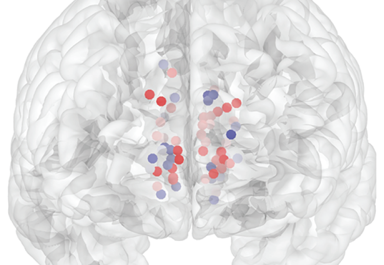 A novel and unique neural signature for depression revealed | Texas ...