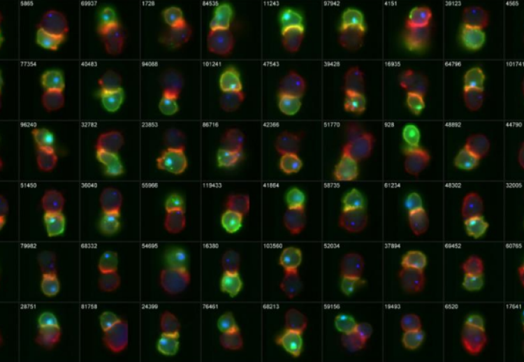 Sprinter and marathoner CAR T cells reveal their distinct cancer ...