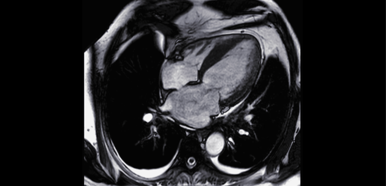 Cardiac Imaging Program | Texas Children's