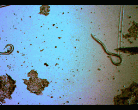 Human Hookworm | Texas Children's